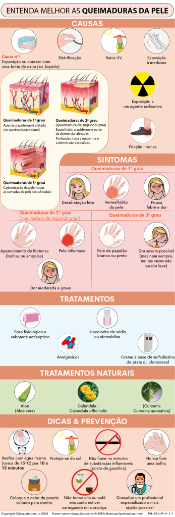 Queimaduras: causas, sintomas & tratamentos | Criasaude